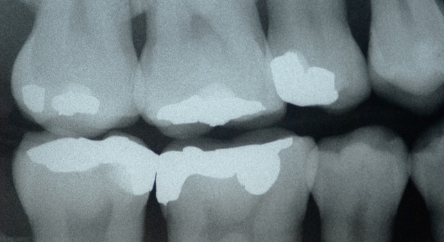 Test Your Radiography Skills - Dimensions' Students