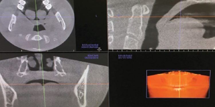 Radiography Archives - Dimensions' Students