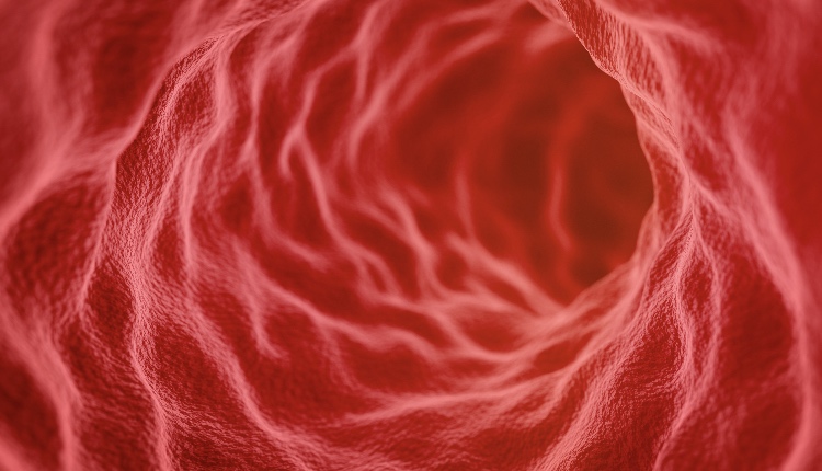 Caring for Patients With Bleeding Disorders - Dimensions Students