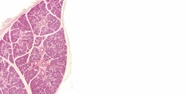 Managing Sialorrhea - Dimensions' Students